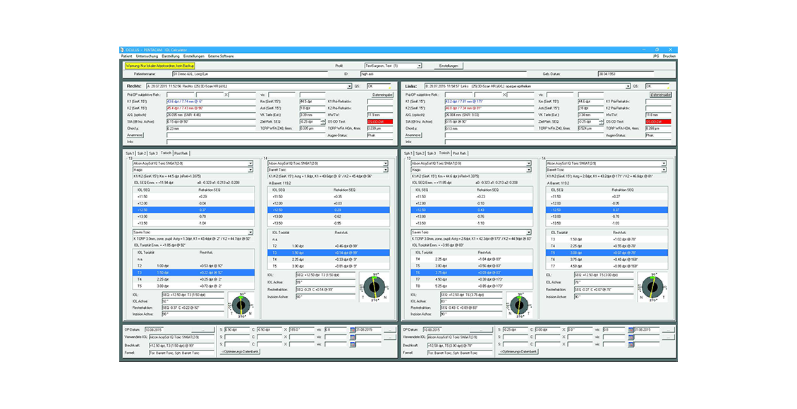 OCULUS Pentacam® Anterior Eye Segment Tomographer